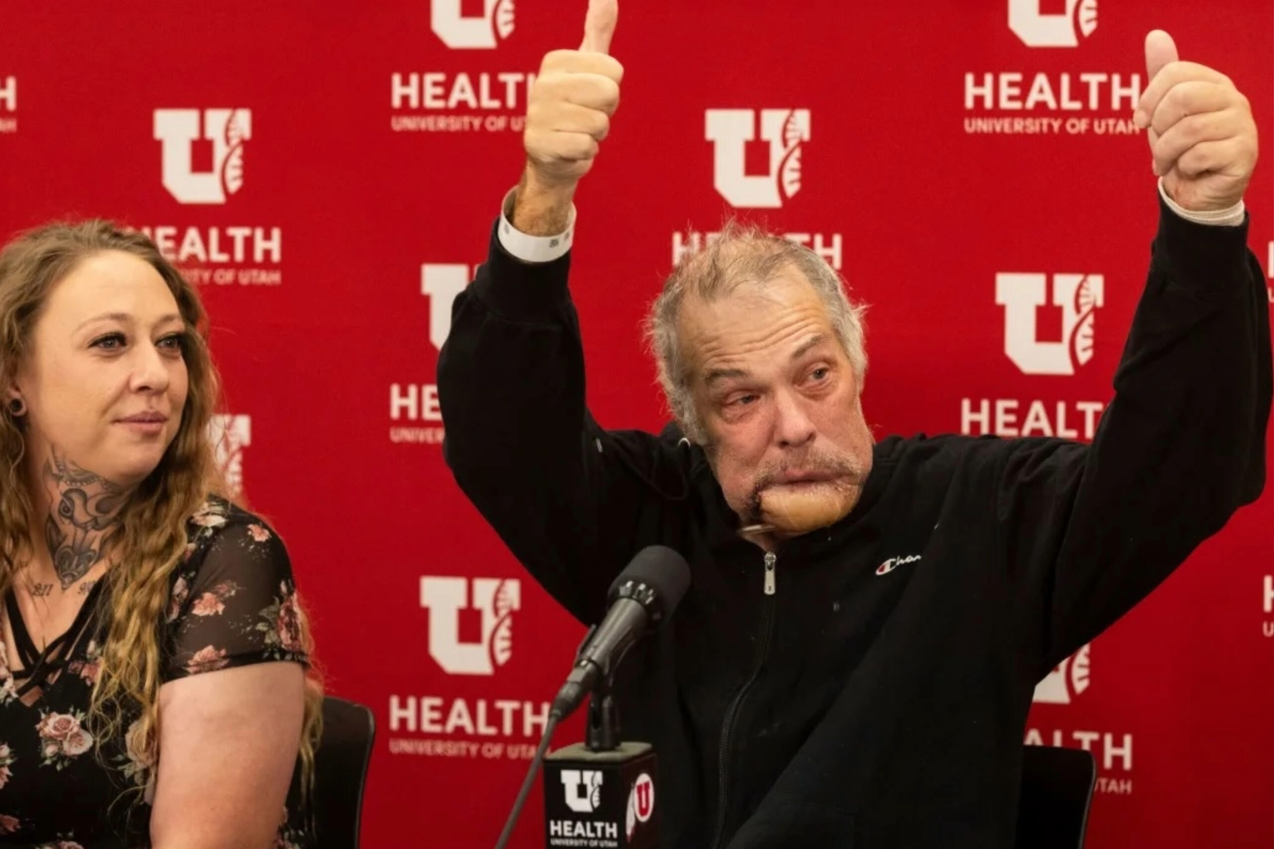 Hombre que perdió la mandíbula en un ataque con un oso dice que quiere ...