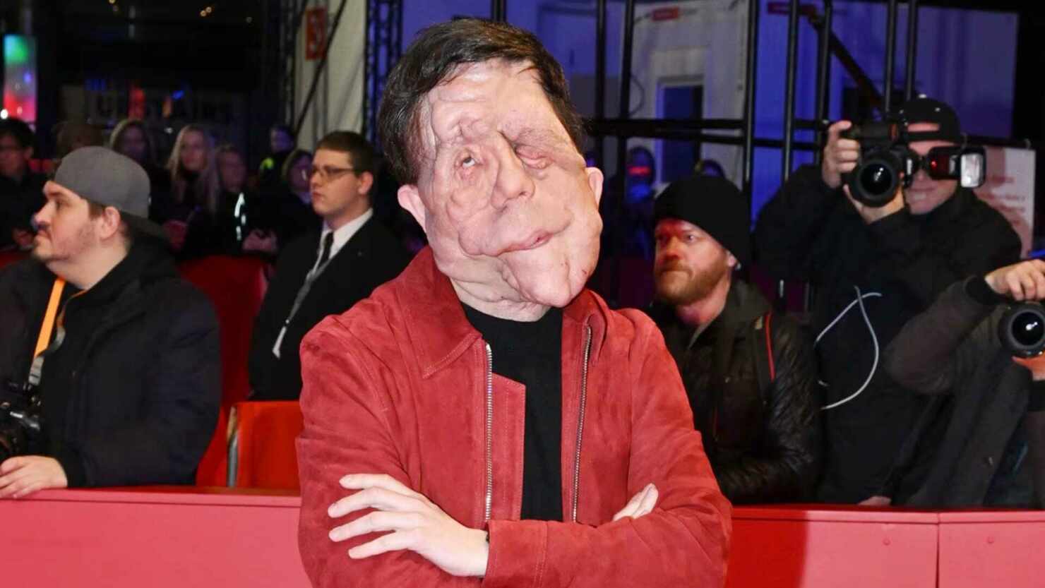 Esta es la extraña enfermedad que sufre el actor Adam Pearson y que le ...